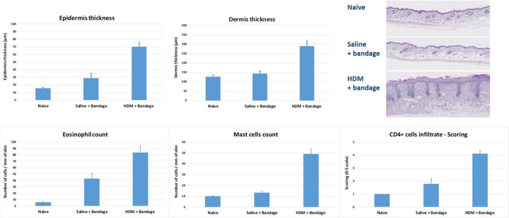 Dermal Models | Skin inflammation | CRO Services