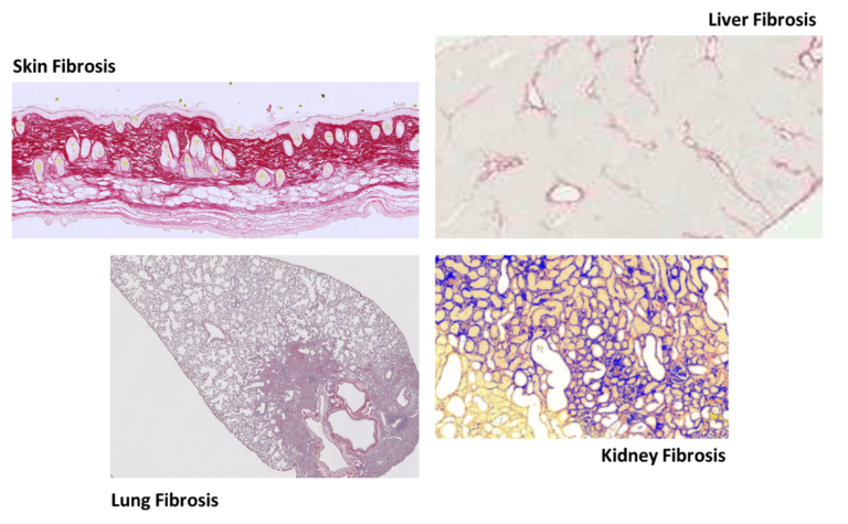 Fibrosis models | Pharmacology support | CRO