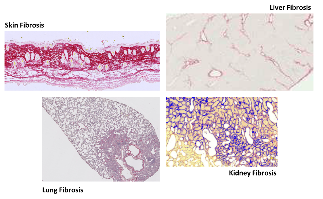 Fibrosis models | Pharmacology support | CRO