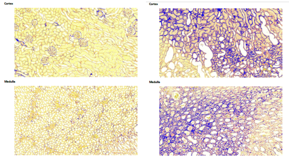Fibrosis models | Pharmacology support | CRO