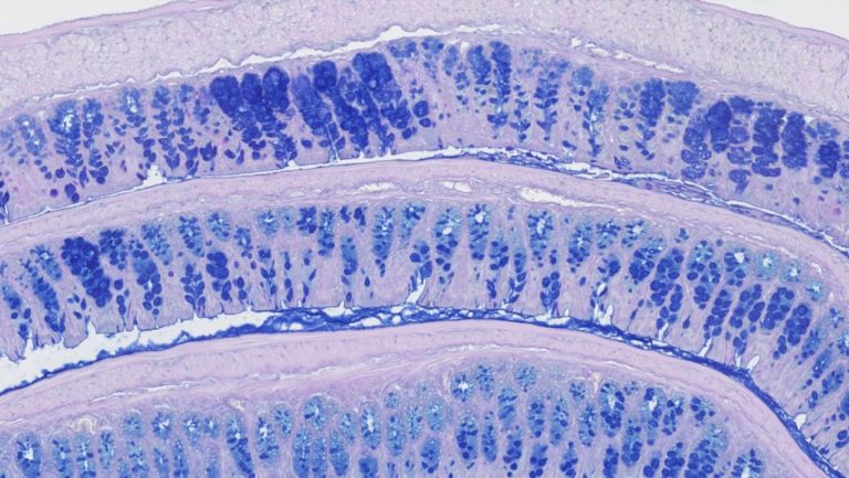 Psoriasis models | Pharmacology support | CRO